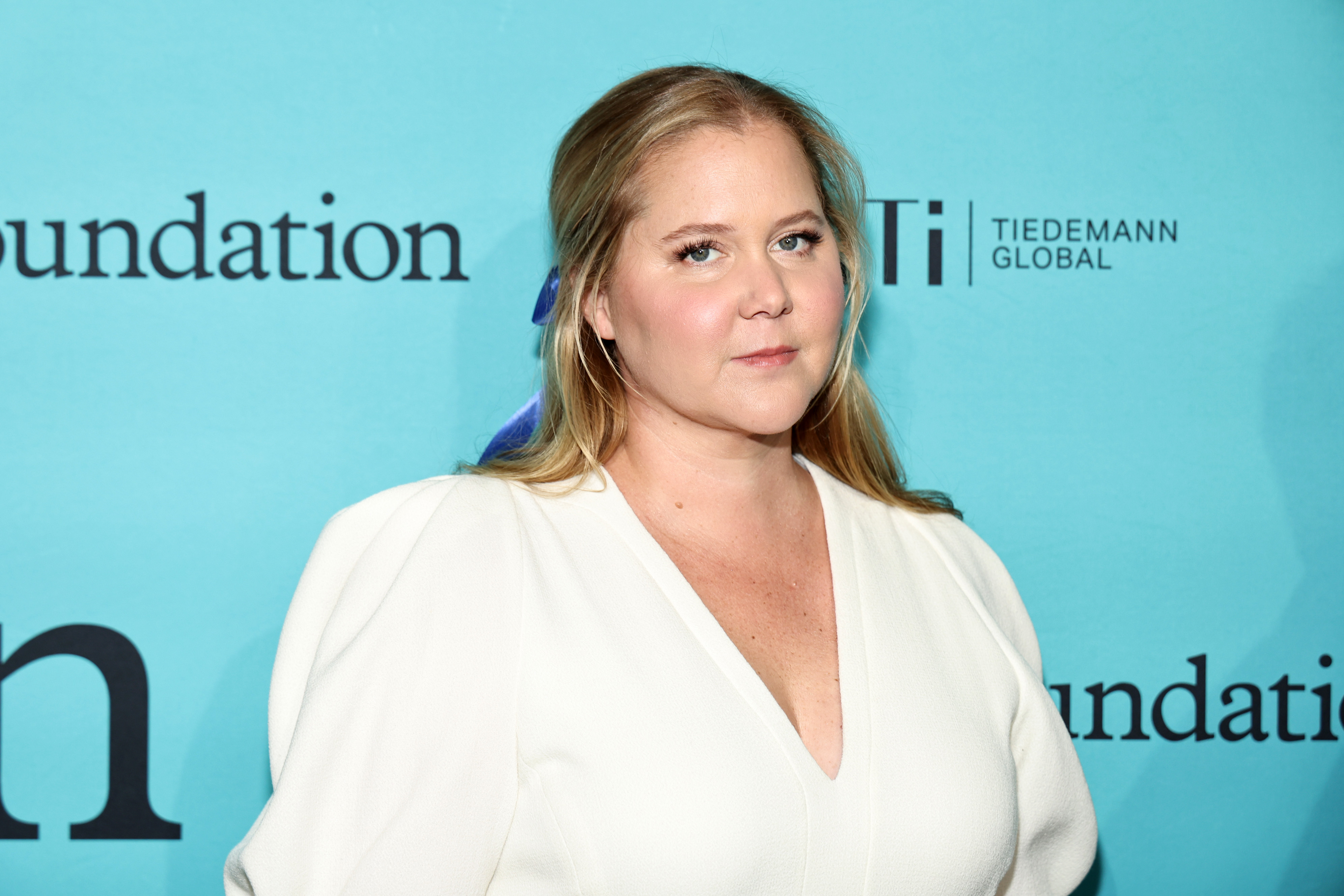 Amy Schumer Reveals She Lost 50 pounds To ‘Survive’ A Disease