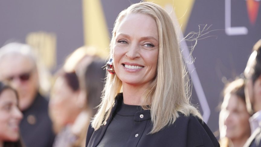 How Did Charlie Puth Get the Scar on His Eyebrow?